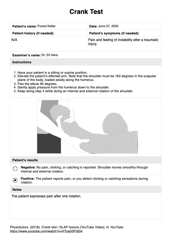 Crank Test & Example | Free PDF Download