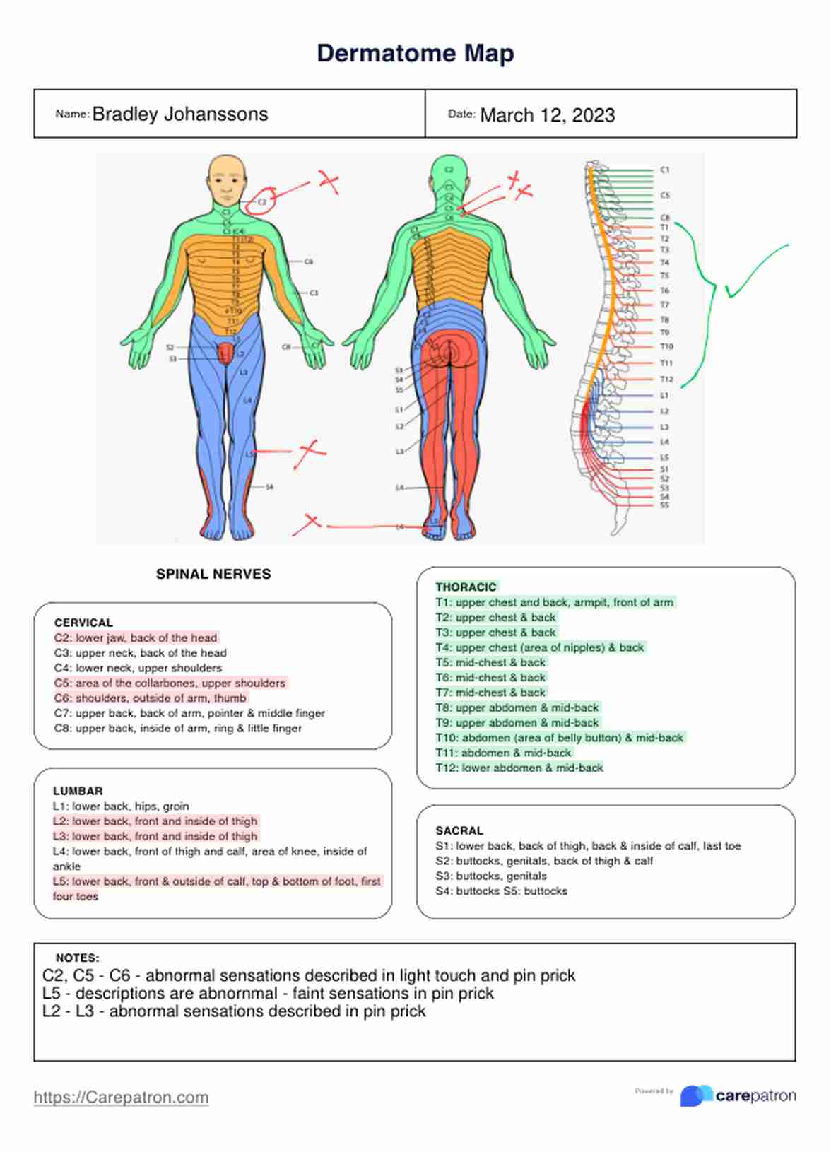 Dermatome Map & Example | Free PDF Download
