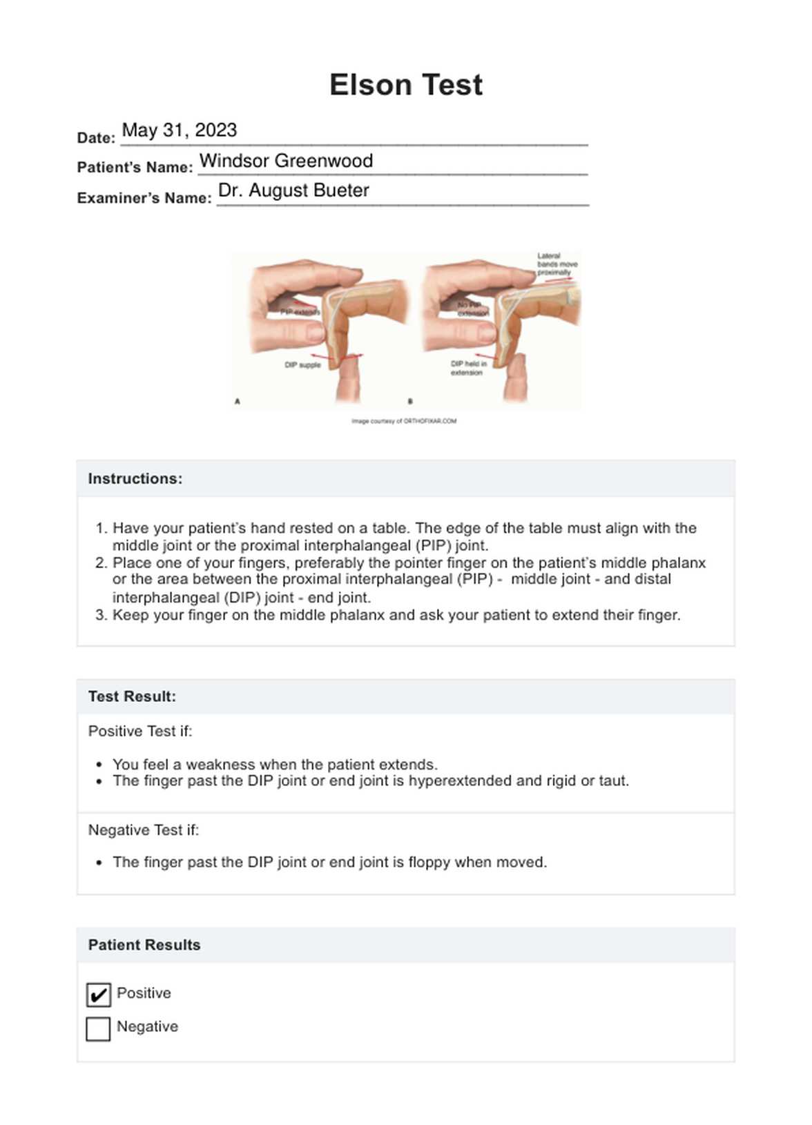Elson Test & Example | Free PDF Download