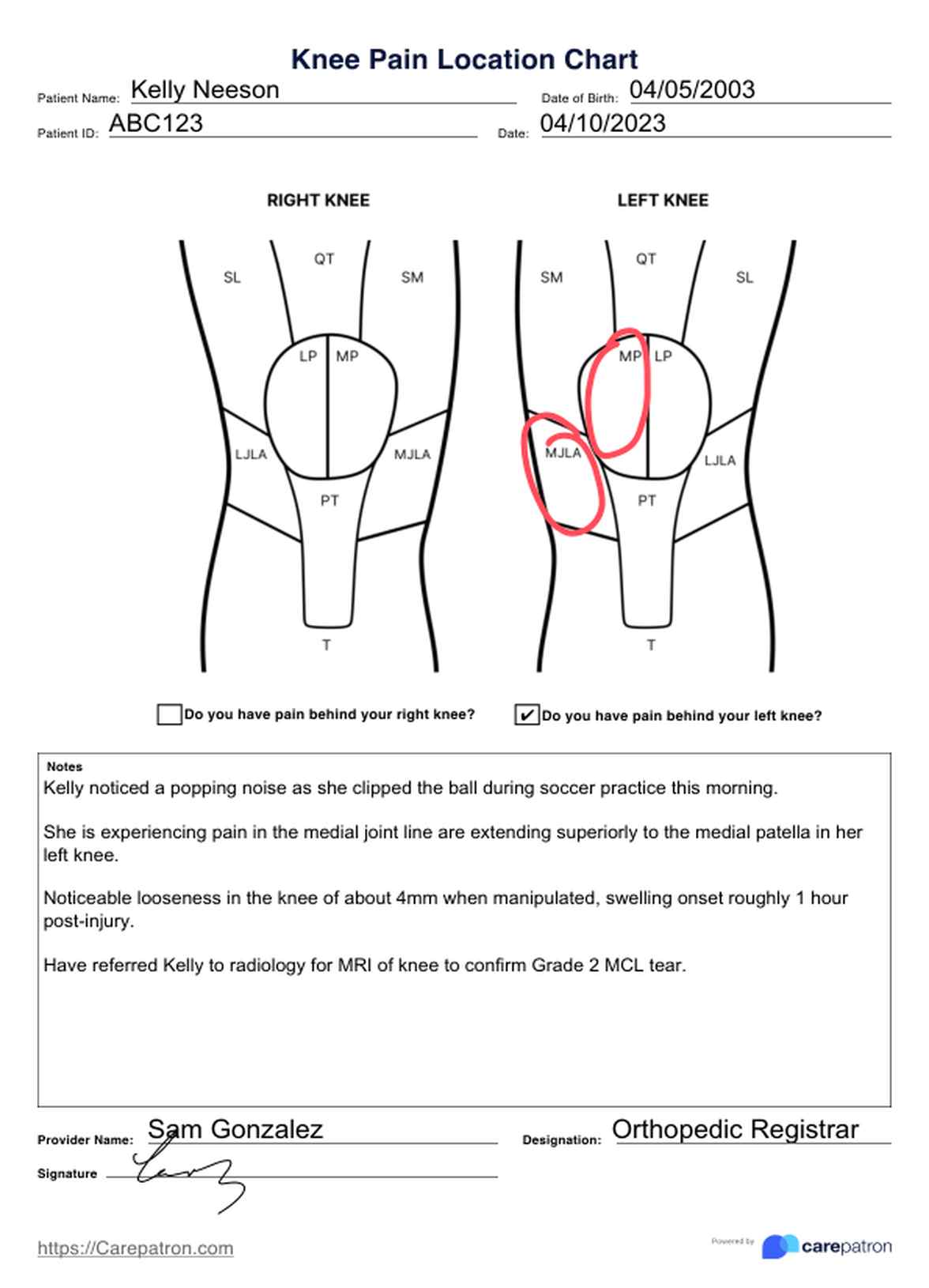 Knee Pain Location Chart & Example | Free PDF Download