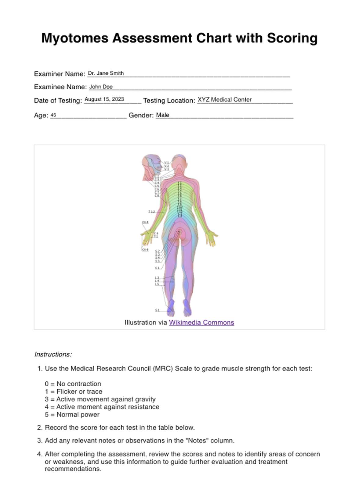 Myotomes Chart & Example | Free PDF Download