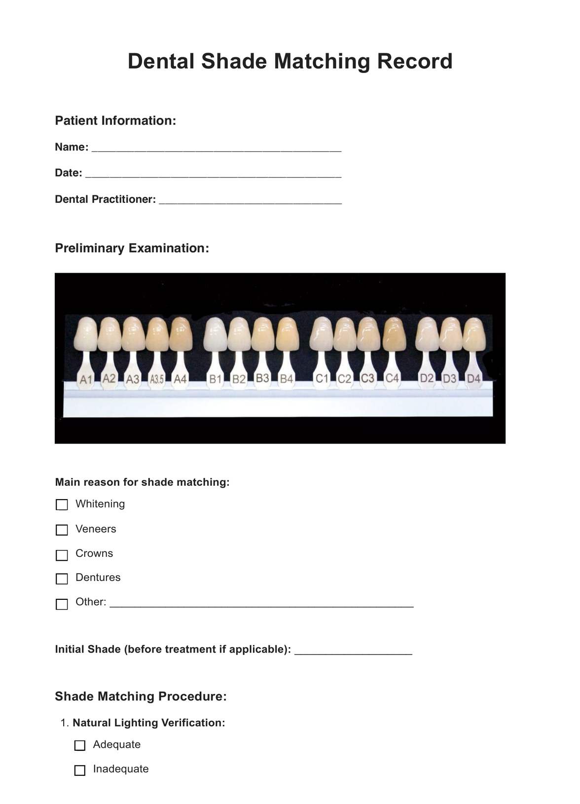 Wisdom Teeth Chart & Example | Free PDF Download